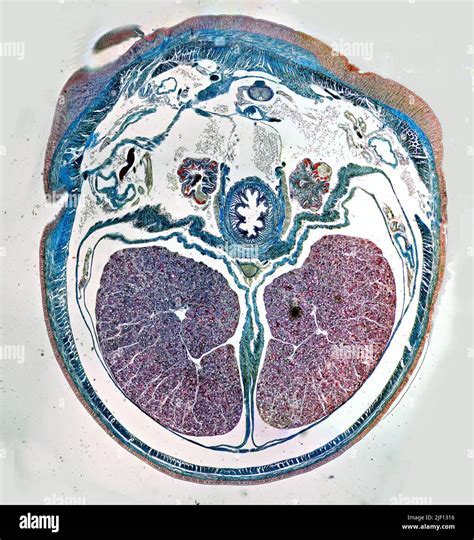 Where Are The Reproductive Organs On A Tapeworm