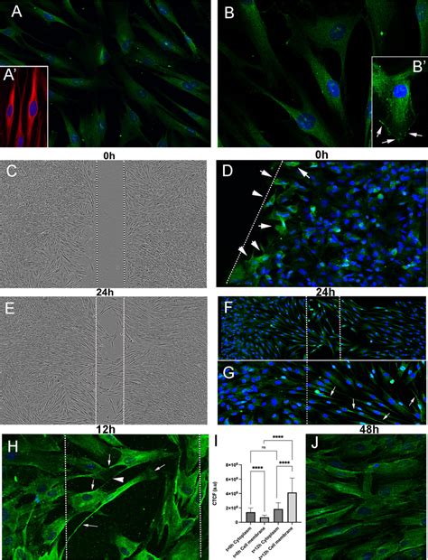 Ace2 Expression In Migrating Neural Crest Progenitors A B Anti Ace2