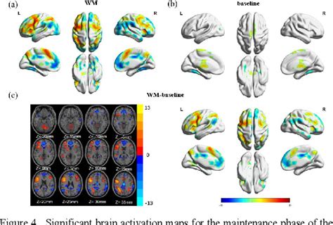 Figure 1 From Hemispheric Lateralization And Top Down Regulation Of The Prefrontal Cortex On