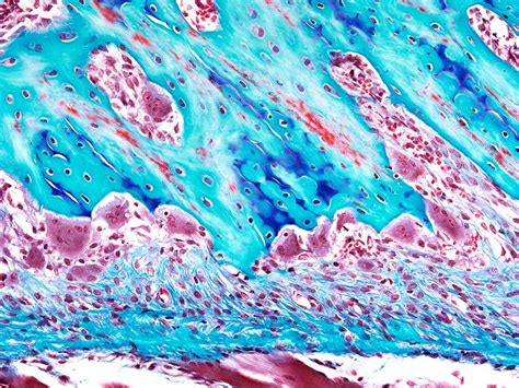 Osteoclasts Light Micrograph Stock Image C0248096 Science Photo