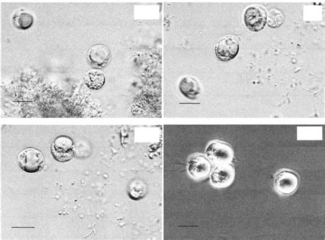 A B C D Various Photographs Of A Same Sample Of Protist Isolated