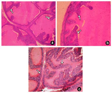 A Photomicrograph Of Seminal Vesicle In Control Group Showing Normal