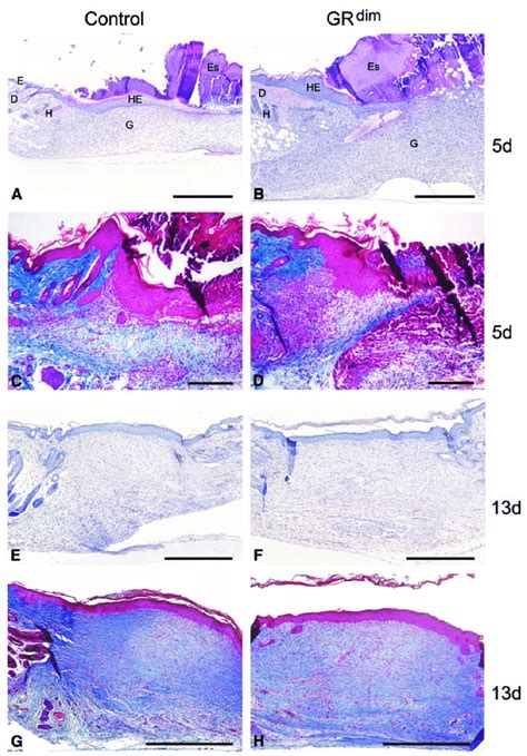 Granulation Tissue Formation Wound Healing An Overview Rvpz