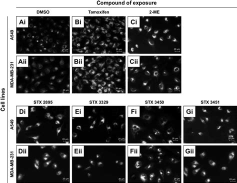 Fluorescent Microscopy Demonstrating Acidic Vesicles Via Mdc Staining
