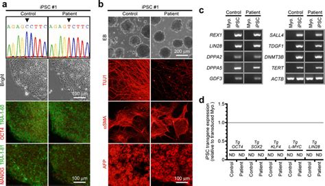 Generation Of Disease Relevant Ipscs Carrying All Mutant Mitochondrial