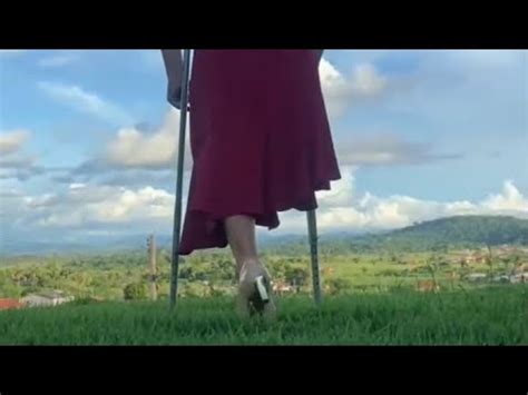One Legged Amputee Woman Walking With Crutches And High Heel Amputee