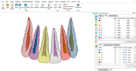 Figure 1 From Age Estimation Based On Pulptooth Volume Ratio Of Anterior Teeth In Cone Beam