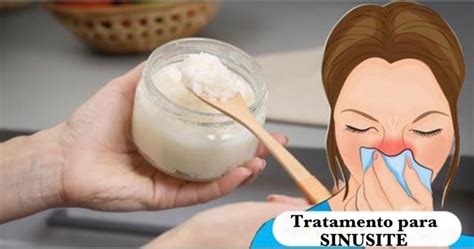 Ci Ncia Mostra Como Tratar A Sinusite Apenas Com Rem Dios Naturais E Com O Que Voc Tem Em Casa