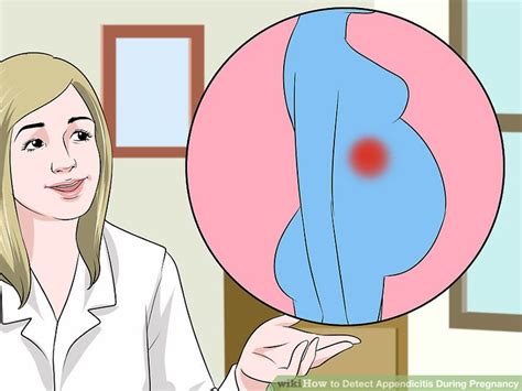 How To Detect Appendicitis During Pregnancy With Pictures