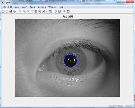 基于霍夫检测（hough变换）的人眼瞳孔定位，matlab实现