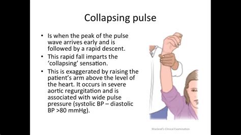 The Science Behind Dr Arthur Cocas Revolutionary Pulse Test Revealed