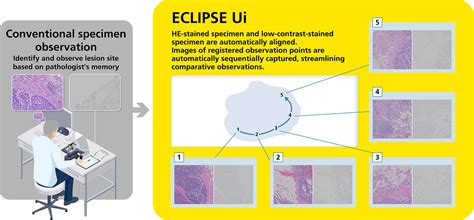 Nikon Launches The Eclipse Ui Ver 1 3 Digital Imaging Microscope For Medical Use News Nikon