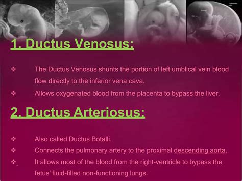 Fetal Circulationpptx