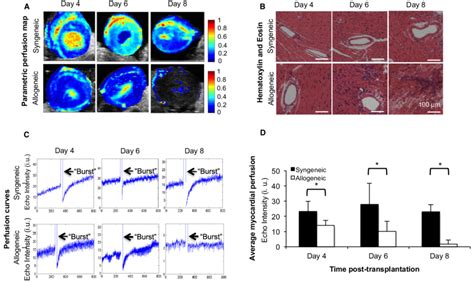 Use Of Mp Mapping To Detect Acute Heart Allograft Rejection Parametric