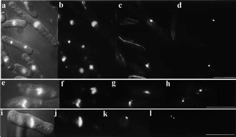 Spi1 25 Cells Show Mitotic Spindle Defects Early Mitotic Spindle Download Scientific Diagram