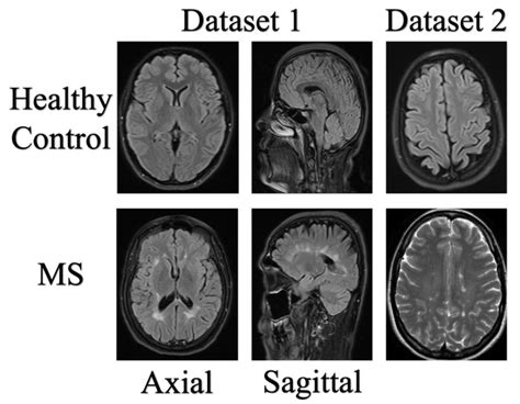 Sample Images In Datasets Download Scientific Diagram
