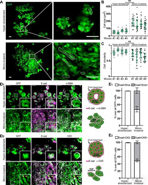 Madm Mutant Cells Undergo A Partial Luminal To Basal Transition Upon