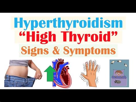 Hyperthyroidism Causes