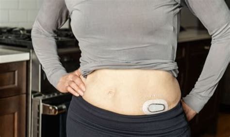 Dexcom G7