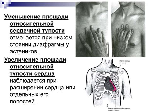 Обследование больных с патологией органов кровообращения Опрос Осмотр Пальпация Перкуссия