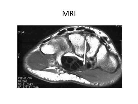 Soft Tissue Swelling Ppt