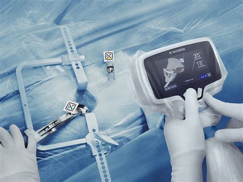Fda Gives Nod To Naviswiss Hip Surgery Navigation System 2020 06 19