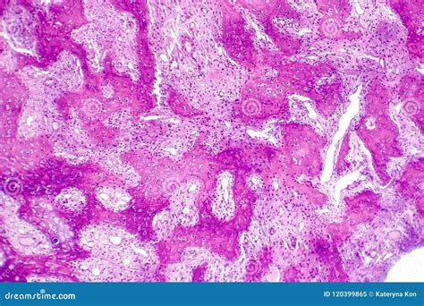 Histology Of Skin Collagen Royalty Free Stock Image