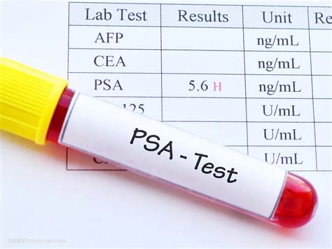 认识男性肿瘤标志物中的优等生 ——前列腺特异抗原（psa） 春雨医生