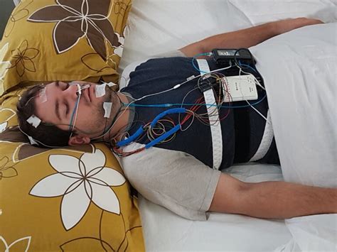 Obstructive Sleep Apnoea Cause Symptoms Management Geeky Medics