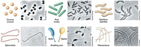 Microbio Lecture 5 — Characterizing Prokaryotes Flashcards Quizlet