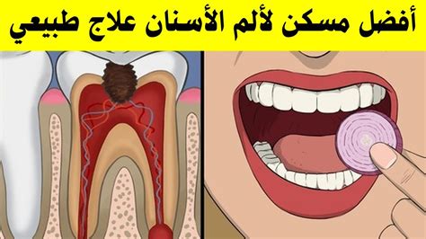 افضل مسكن لالم الاسنان علاج طبيعي تسكين الم الاسنان الشديد اقوى