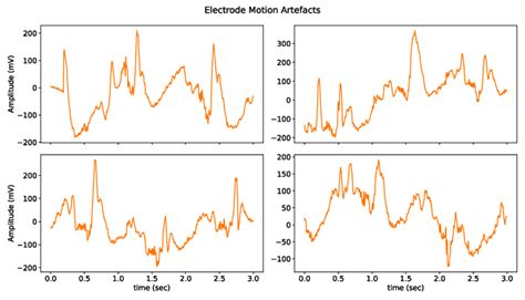 Examples Of Electrode Motion Artefacts That Have Are Added To The Download Scientific Diagram