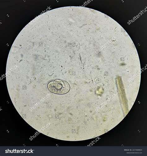 Strongyloides Stercoralis Embryonated Egg Nematode Worm Stock Illustration 2277688823 Shutterstock