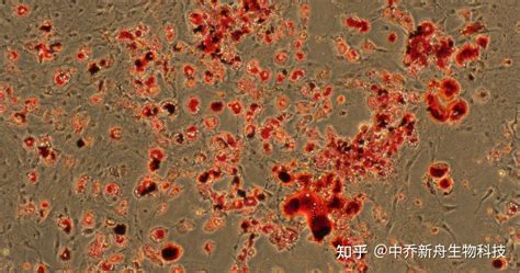 【细胞课堂】3t3 L1细胞培养及成脂诱导分化实验 知乎