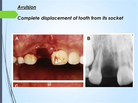 Ppt Orofacial Trauma Diagnosis And Management Options Powerpoint
