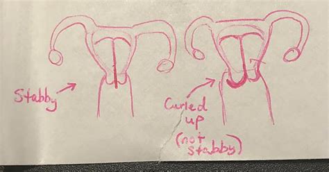 Why You Actually Want Longer Iud Strings Album On Imgur