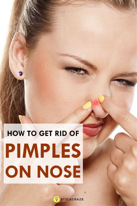 6 Easy Diy Remedies To Get Rid Of Pimples On The Nose How To Get Rid Of Pimples Back Acne