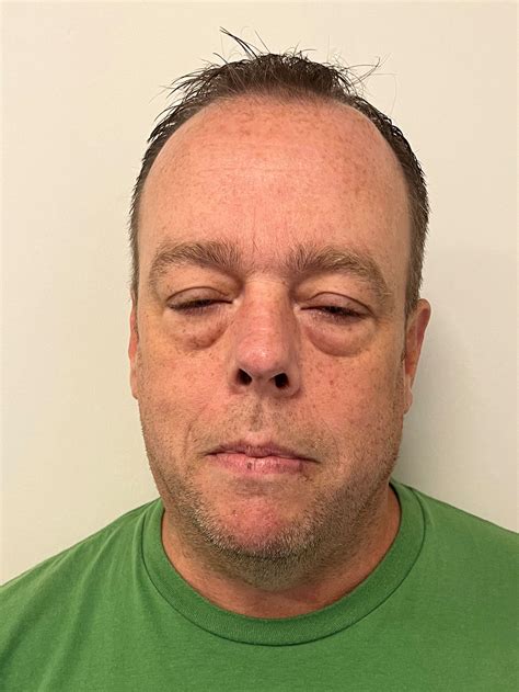 Eric J Welch Sex Offender In Saratoga Springs Ny 12866 Ny22845