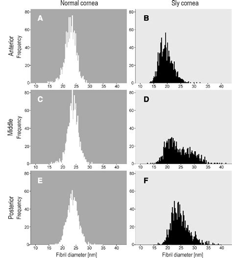 Figure 1 From Large Proteoglycan Complexes And Disturbed Collagen
