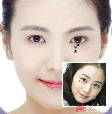 右下眼睑有痣命运图 图库 五毛网