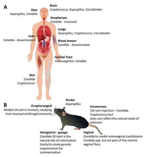 Human Fungal Infections