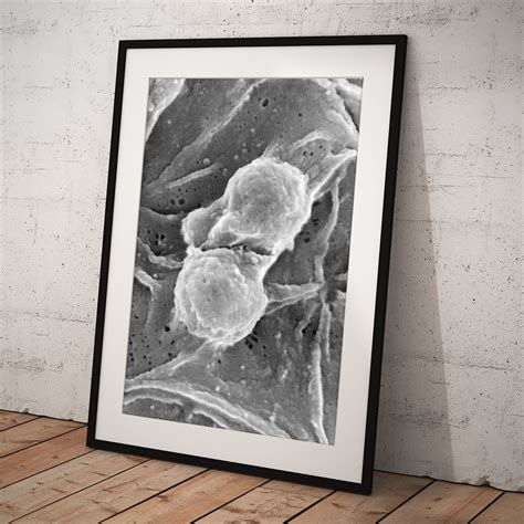 Plasmodium Falciparum Ring Stage Art Print By Science Photo Library