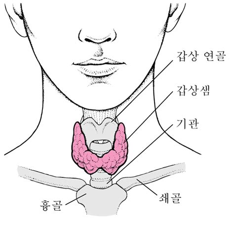 영아와 소아의 갑상선기능항진증 아동의 건강 문제 Msd 매뉴얼 일반인용