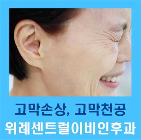 분당이비인후과 고막천공수술 귀 통증 발생했다면 네이버 블로그