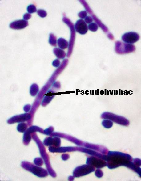 Fungal Structures And Mycology Terminologies Essential For