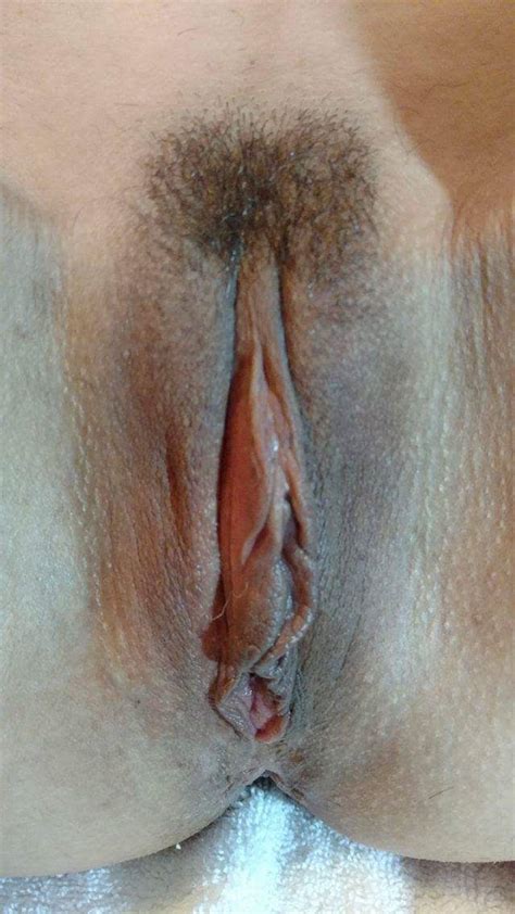 Poll Labia Minora From Hidden To Large Take Your Pick Page 2 Xnxx Adult Forum