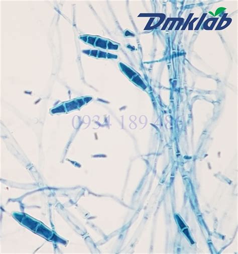 Tiêu Bản Nấm Microsporum Gypseum Dmk Lab
