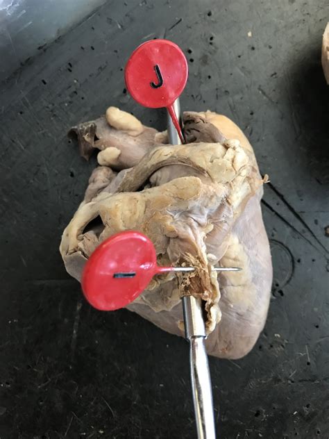 Heart Pt 3 Diagram Quizlet