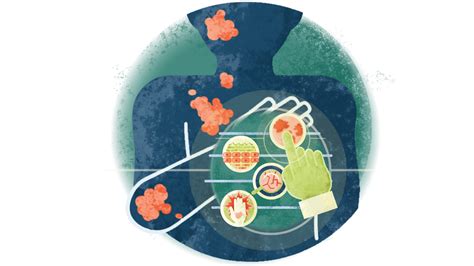 Atopic Dermatitis Medical Journeys 乌鸦传媒