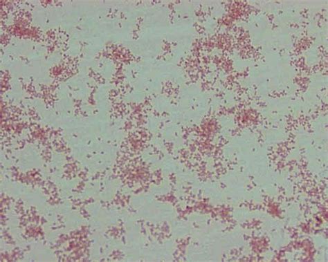 B Abortus S99 Strain Stained With Grams Staining And Observed Under
